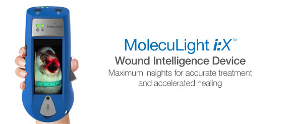 Better Wound Healing With Lower Costs - MolecuLight US