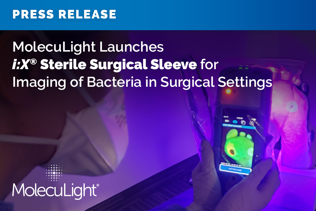 MolecuLight Launches i:X® Sterile Surgical Sleeve