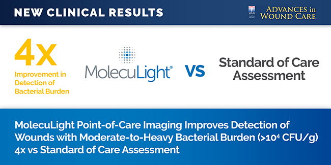 MolecuLight Improves Bacteria Detection in Wounds by 4x