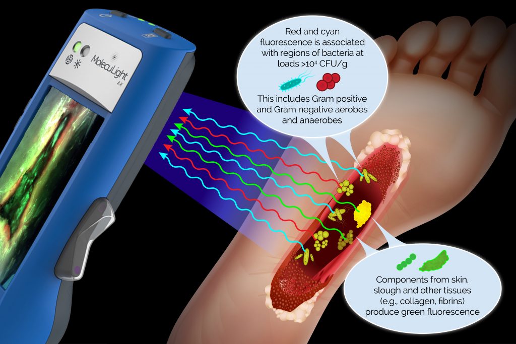 Visualize Bacteria | MolecuLight