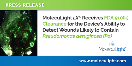 MolecuLight i:X® Receives FDA 510(k) Clearance