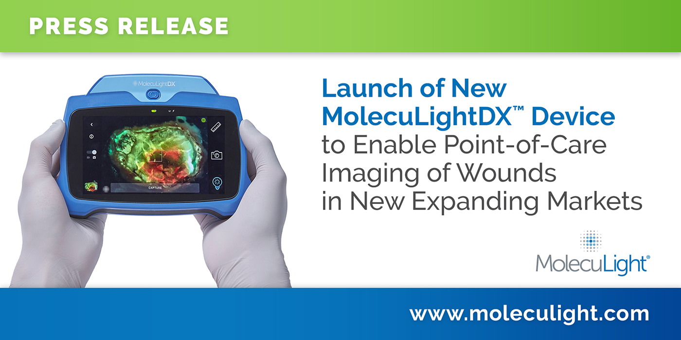MolecuLightDX™ Device to Enable Point-of-Care Wound Imaging