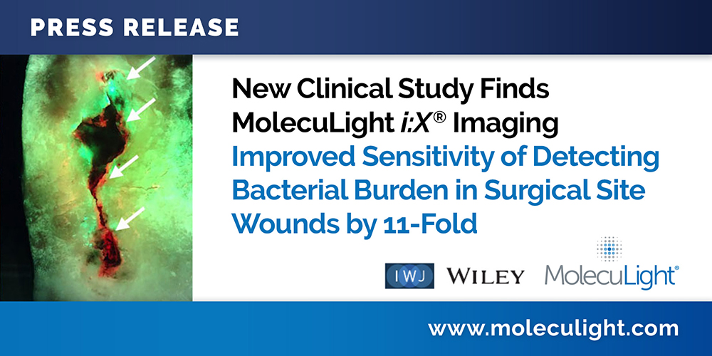 Study Finds MolecuLight i:X® Improved Bacteria Detection
